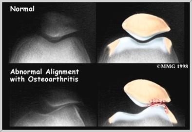 Scuola internazionale di Osteopatia European Osteopathic Project ...